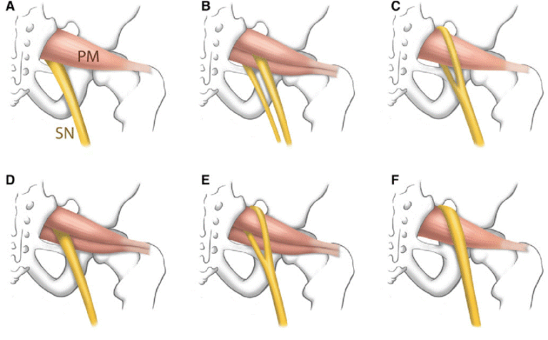 TIPOS DE MUSCULO PIRAMIDAL – Enriquerubio.net