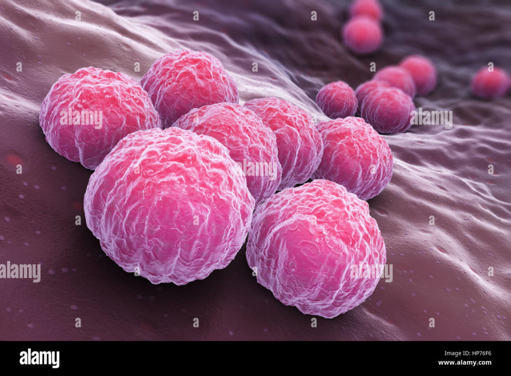 vasculo cerebral – Enriquerubio.net