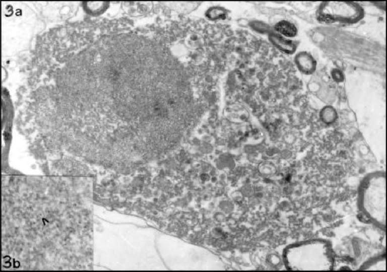 OLIGODENDROCITOS GENERALIDADES – Enriquerubio.net